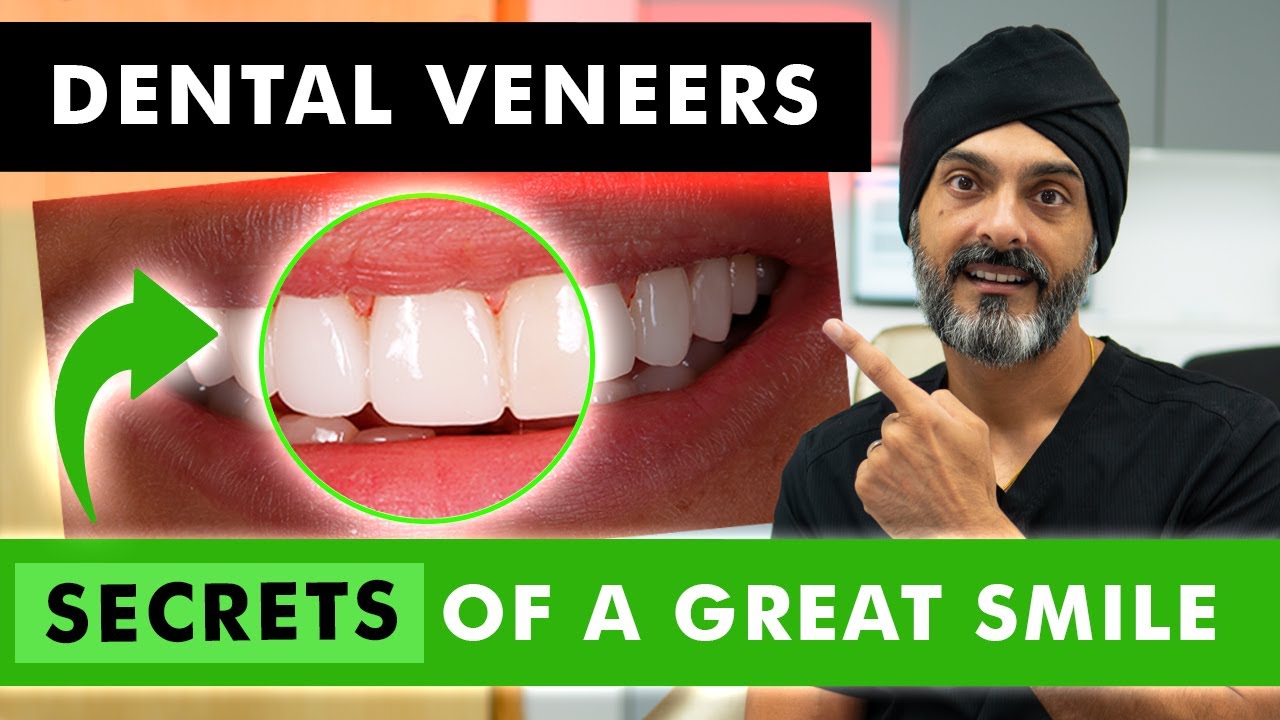 Dental Veneer Options in 2025: Composite vs Porcelain Explained