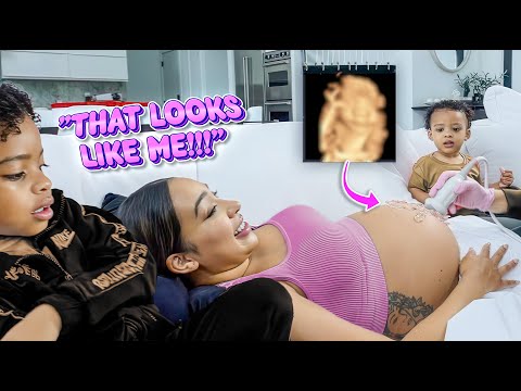 You’ll Never Guess Who Baby #3 Looks Like! + Guessing Babies Gender 👀 *4D Ultrasound*