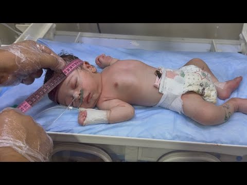 Checking OFC of Newborn Baby | Gentle Care & Monitoring | Royal Nursery Unit