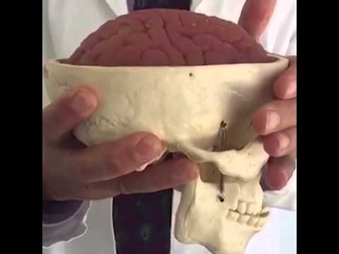 What Happens in a Coup Contrecoup Injury / Concussion Event?