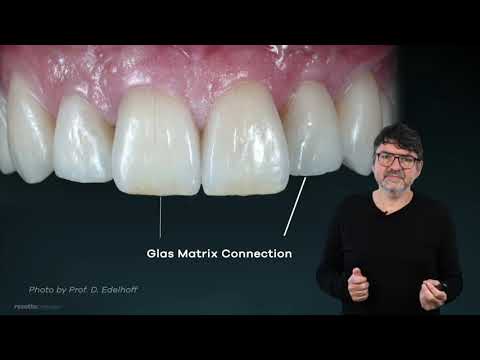 DCM Hotbond - A glass matrix solution for dental bonding (Tutorial)