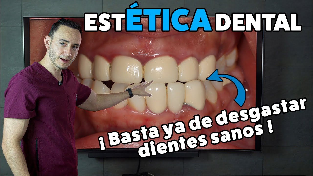 Carillas y Coronas en dientes sanos. ¿Y la ética dónde queda?