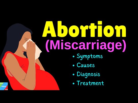 Abortion (Miscarriage) – Symptoms, Causes, Diagnosis, Treatment & Prevention