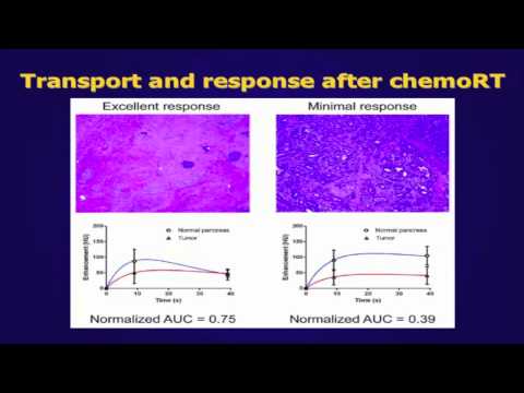 Pancreatic cancer properties describe gemcitabine response