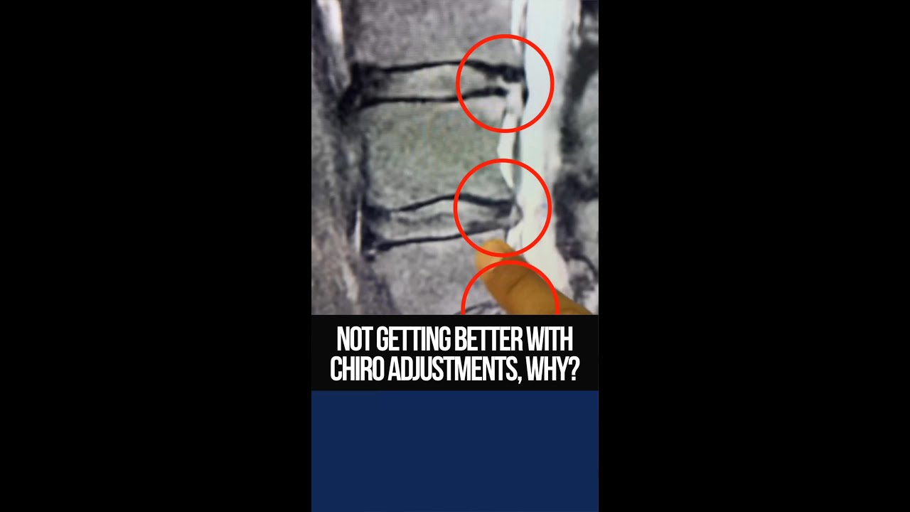 Discover How Spinal Decompression Can Relieve Your Back Pain
