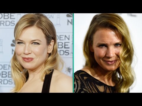 Here's What Renee Zellweger Told ET About Plastic Surgery -- Back in 2002