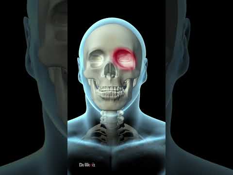 The Most Painful Types of Headaches Explored