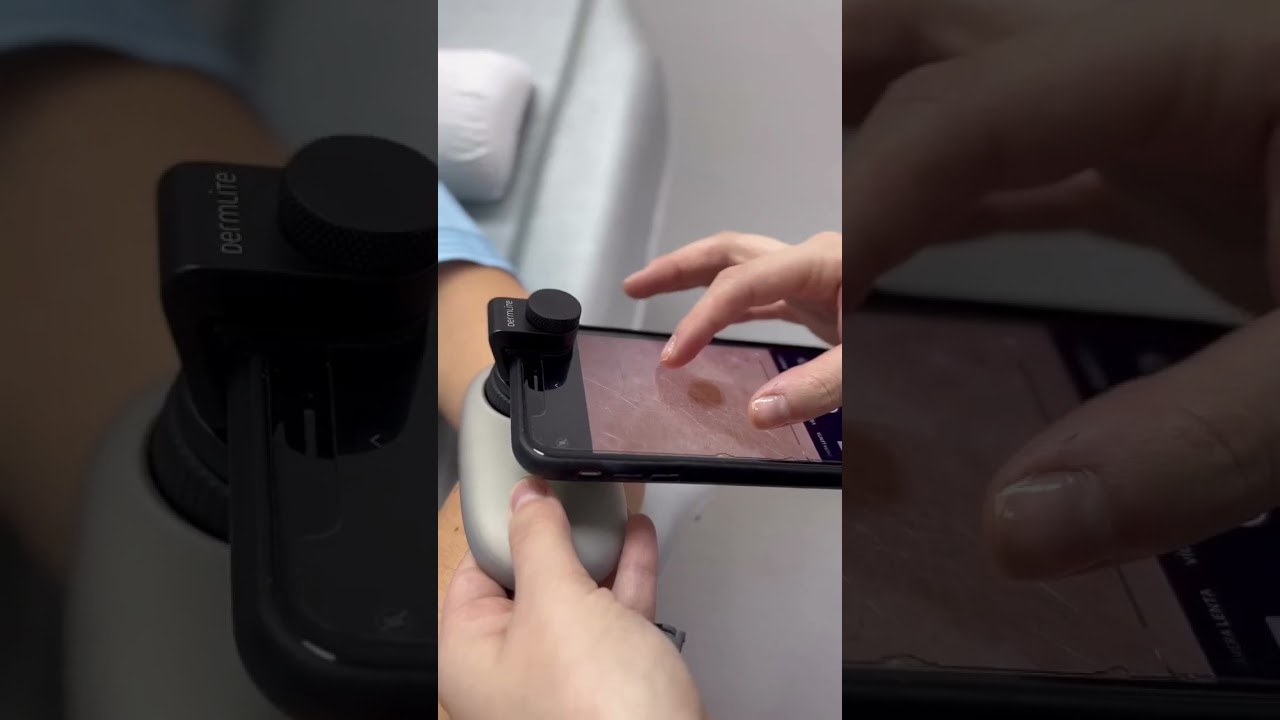 Dermatoscopia o que e?