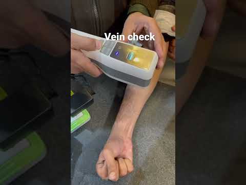 how to check your vein#vein finder