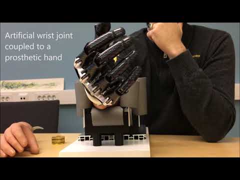 New Cyborg Wrist Gives Unprecedented Motion to Amputees