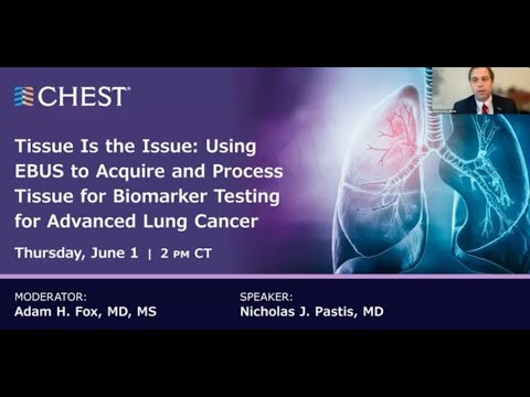Tissue is the Issue: Using EBUS to Acquire & Process Tissue for Biomarker Testing in Adv Lung Cancer