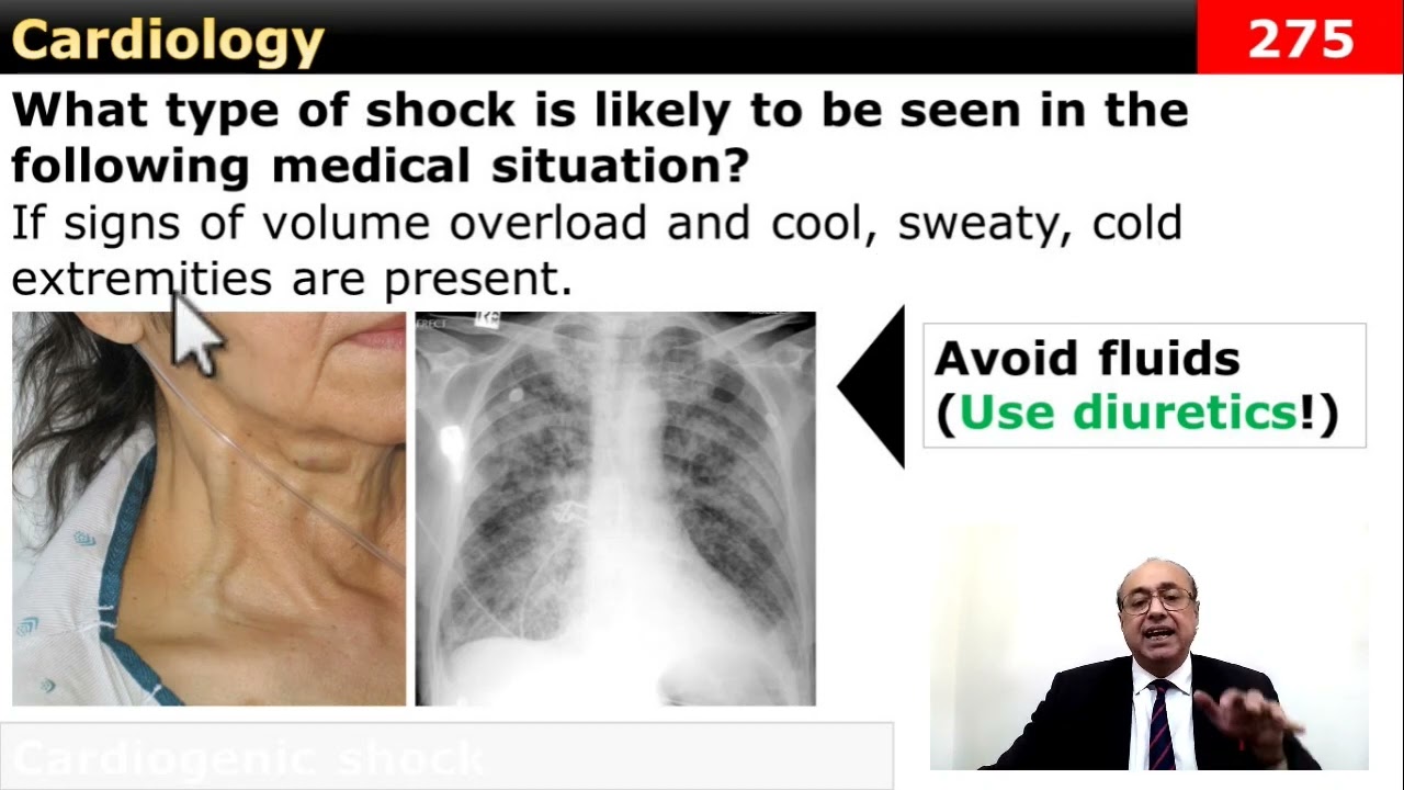 Cardiology (Quick Note) #internal_medicine #cme #usmle #ecg #محاضرات_باطنة   #medicine #diagnosis