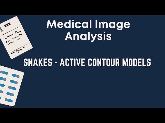 Understanding Active Contour Models: The Mechanics of Snakes | Galaxy