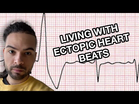 5 Tips for Living with Anxiety and Ectopic Heart Beats