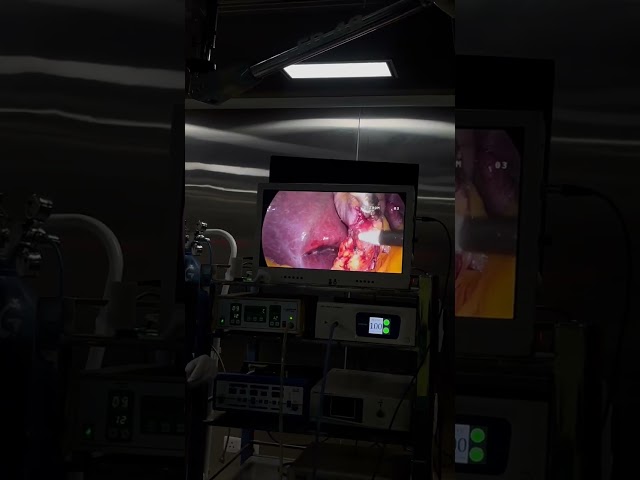 Urology Instruments - Telepack Endoscopy System Manufacturer from Ghaziabad