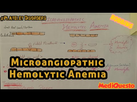Microangiopathic Hemolytic Anemia #PlateletDisorders #Hematology@ RobbinsPathology