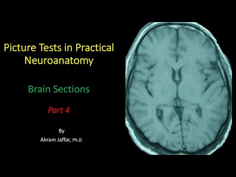 Picture Test in Neuroanatomy Brain Sections 4