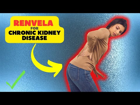 Benefits of Renvela (sevelamer carbonate): A Breakthrough Treatment for Chronic Kidney Disease