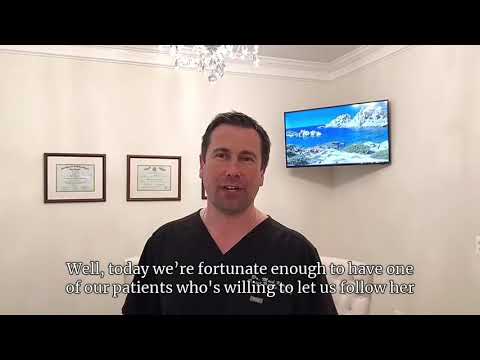 🦋 Dr Mark Karolak ‘s Facelift and Neck Lift 🦋