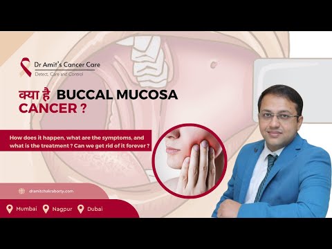 Buccal Mucosa Cancer क्या है ? | Dr.Amit Chakraborty | Dr. Amits Cancer Care
