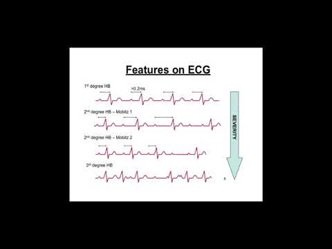 Cardiology - ECG interpretation