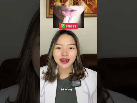 PENYEBAB SARIAWAN BENERAN KARENA KURANG VITAMIN? #skincaretips #aestheticdoctor #sariawan #skincare