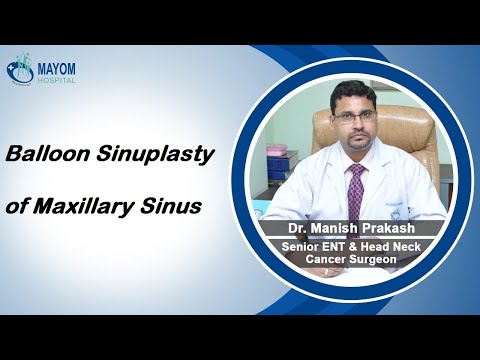 Balloon sinuplasty of Maxillary sinus