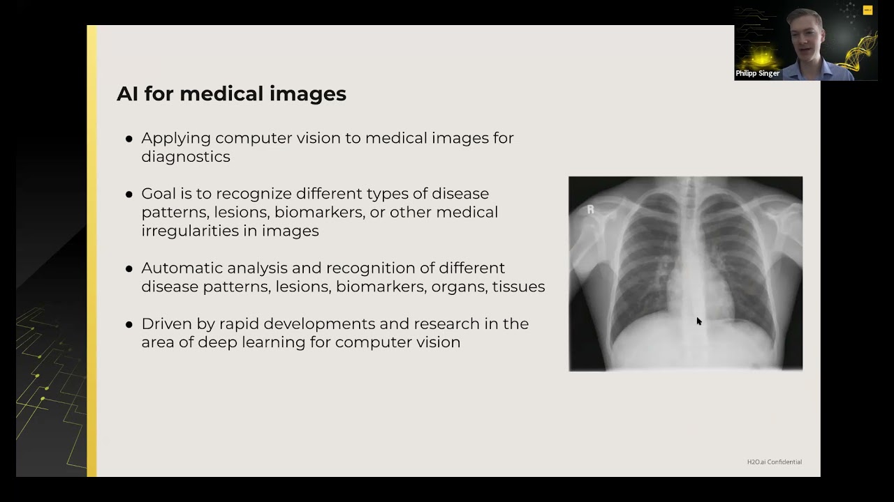 Kaggle Grandmaster Webinar: Computer Vision & Deep Learning to improve medical diagnostics