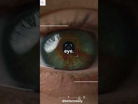 Why Do Some People Have Different Colored Eyes? The Science of Heterochromia
