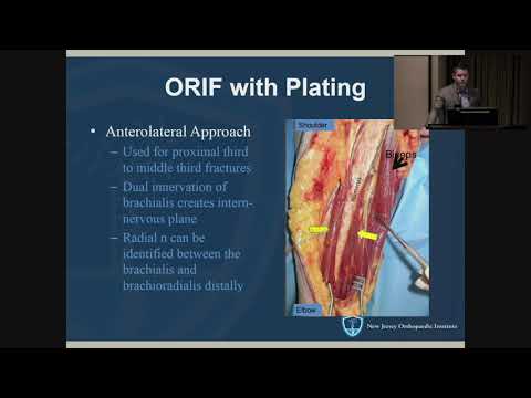 Humeral Shaft Fractures - John Callaghan, MD