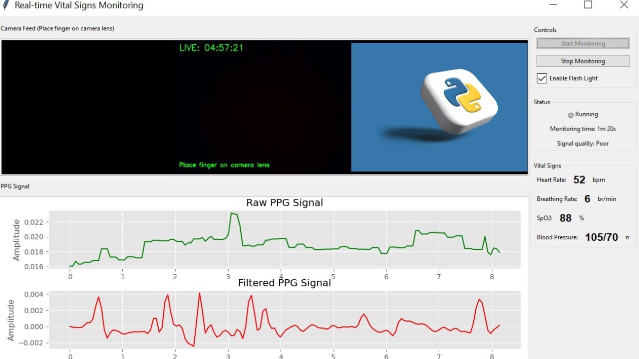 Real-Time Vital Signs Monitor using Python & OpenCV | Heart Rate, SpO2, Breathing Rate GUI App