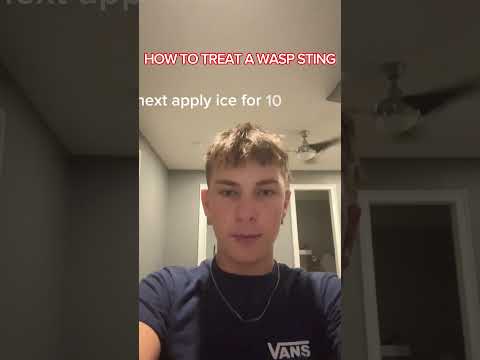 How to treat a Wasp Sting #emergency