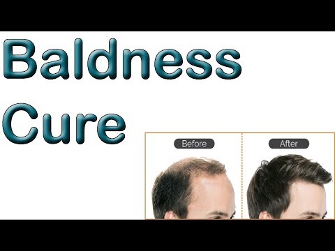 Baldness Cure – 100% Natural Remedy To Cure Baldness – Best Home Remedies