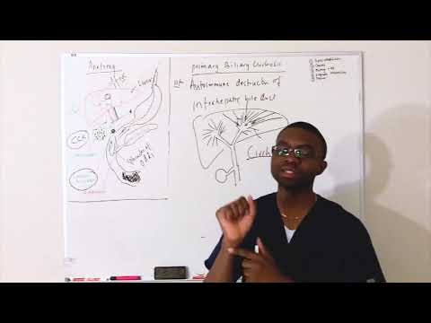 Primary Biliary Cirrhosis Lecture