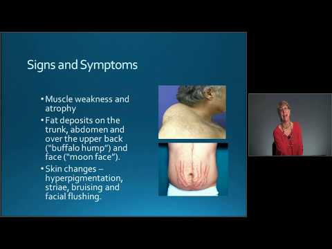 Medical-Surgical Nursing Exam Review: Endocrine Disorders - MED-ED