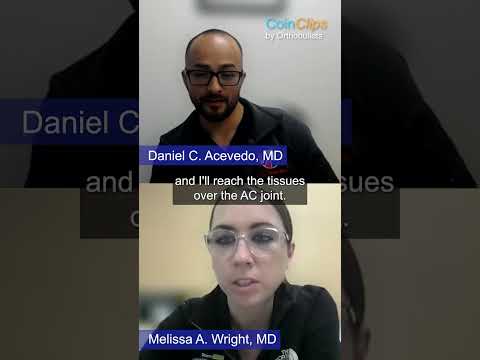 What's the best AC Joint Fixation Technique for treating Acromioclavicular Separation? - Shoulder360