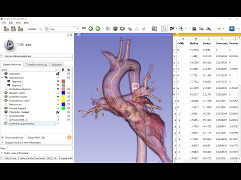 New module: Extract Centerline (in SlicerVMTK extension) - Support - 3D Slicer Community