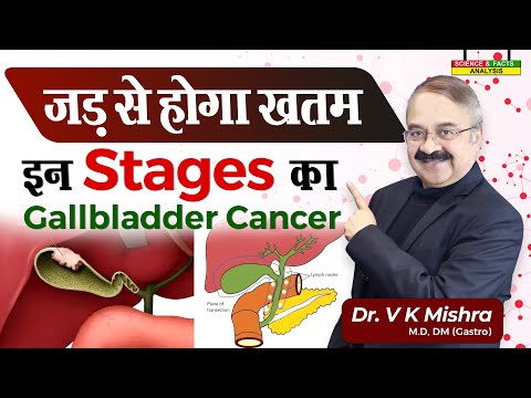 जड़ से होगा ख़त्म इन stages का gallbladder cancer || GALL BLADDER CANCER TREATMENT OPTIONS
