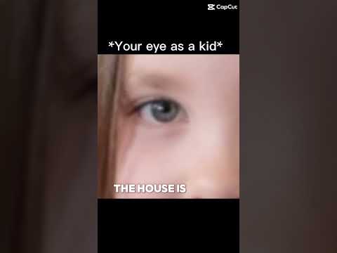 My eye as a kid VS my eye rn #short #eyes #older #capcut #irl #myeyes