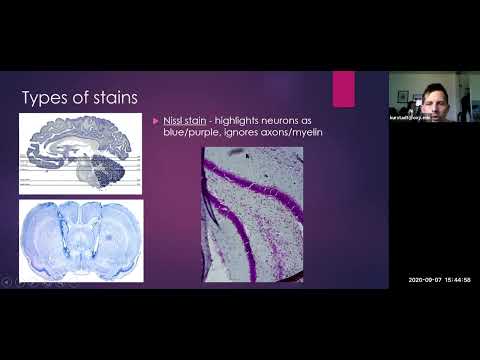 (Some) Ways that brain tissue is stained