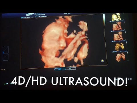 4D/HD ULTRASOUND + BABY UPDATE!