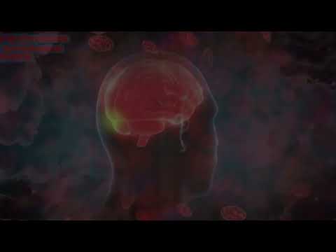20khz fights thrombosis to help stroke and Brain Circulation