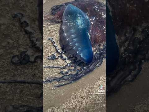 STUNG By A PORTUGUESE MAN O WAR! #portuguesemanowar #short #shorts #siphonophore #jellyfish