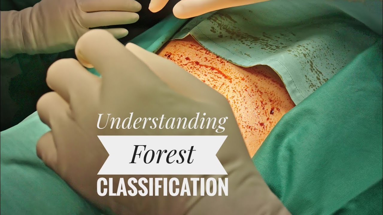 Understanding Forest Classification in Upper GI Bleeding.