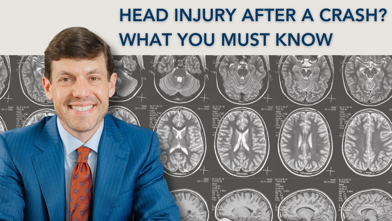 Concussions After Car Accidents: What You Need to Know | Brain Injury Lawyer Kenneth Berger