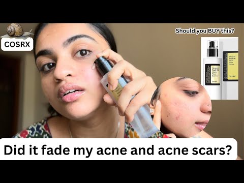 I tried Cosrx Advanced Snail 96 Mucin Power Essence for a Week | Demo + Review on Combination Skin