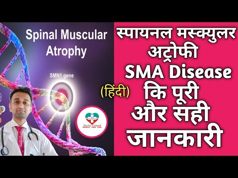 Spinal Muscular Atrophy! SMA बीमारी के कारण, लक्षण और ईलाज। Dr.K.S.Chougule.
