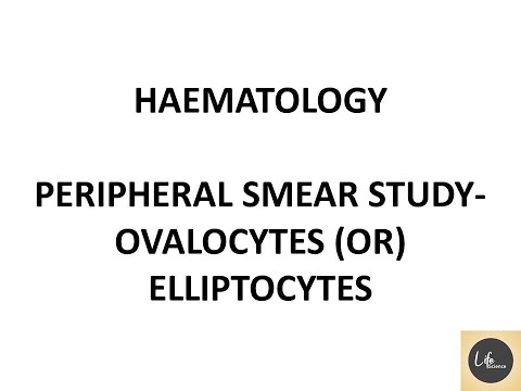 HAEMATOLOGY PERIPHERAL SMEAR OVALOCYTES OR ELLIPTOCYTES/HematologyNotes/Part-71#LifeScienceMCQs