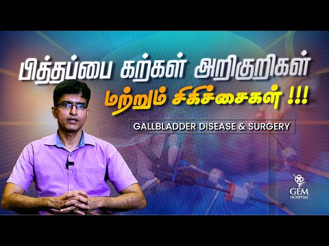 Gallbladder Stones Symptoms | Warning Signs | Surgery for Gallstones in Tamil - Dr Shankar