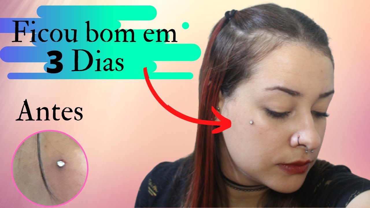 Microdermal inflamado como cuidar